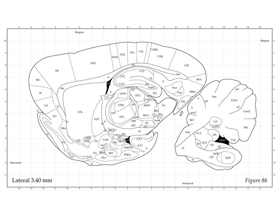 Rat Brain Atlas Rat Brain Atlas